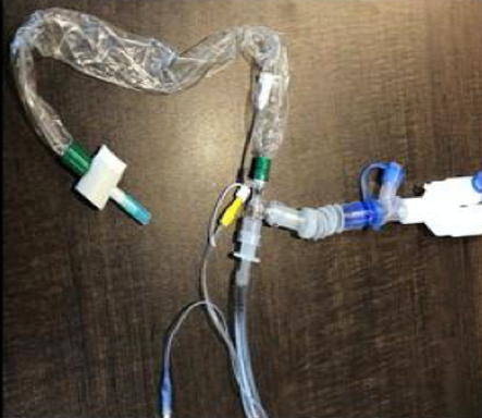 Anesthesia in Patients with Positive COVID Status or Suspected Positive ...